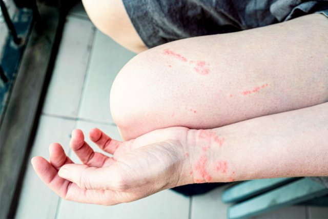 Quallen in Australien: Welche sind giftig oder tödlich?